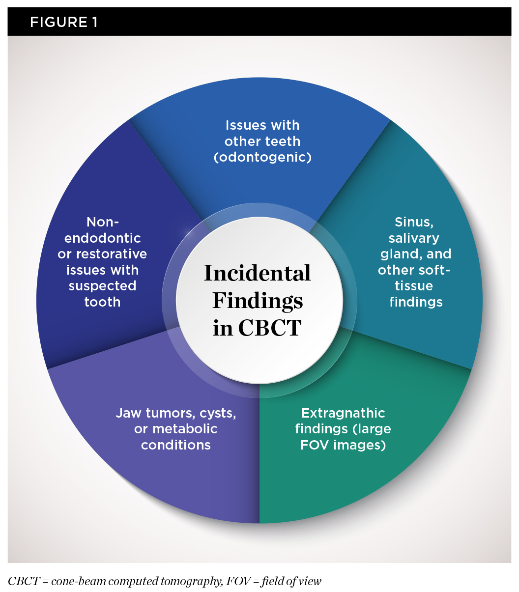 Incidental CBCT Findings: The Importance of Reading the Whole Image ...