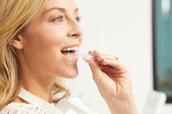 SureSmile® Clear Aligners: Ease of Use, Fewer Refinements, Better Experience | Compendium