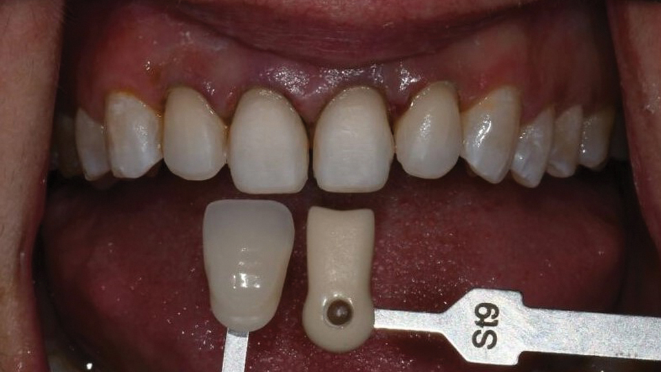 A Systematic Approach to Diagnosing and Managing a Patient With ...