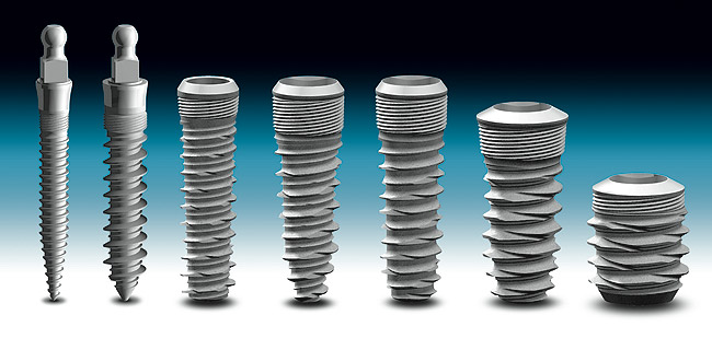 Intra-Lock: "Biologically Driven" Implant Systems | Compendium