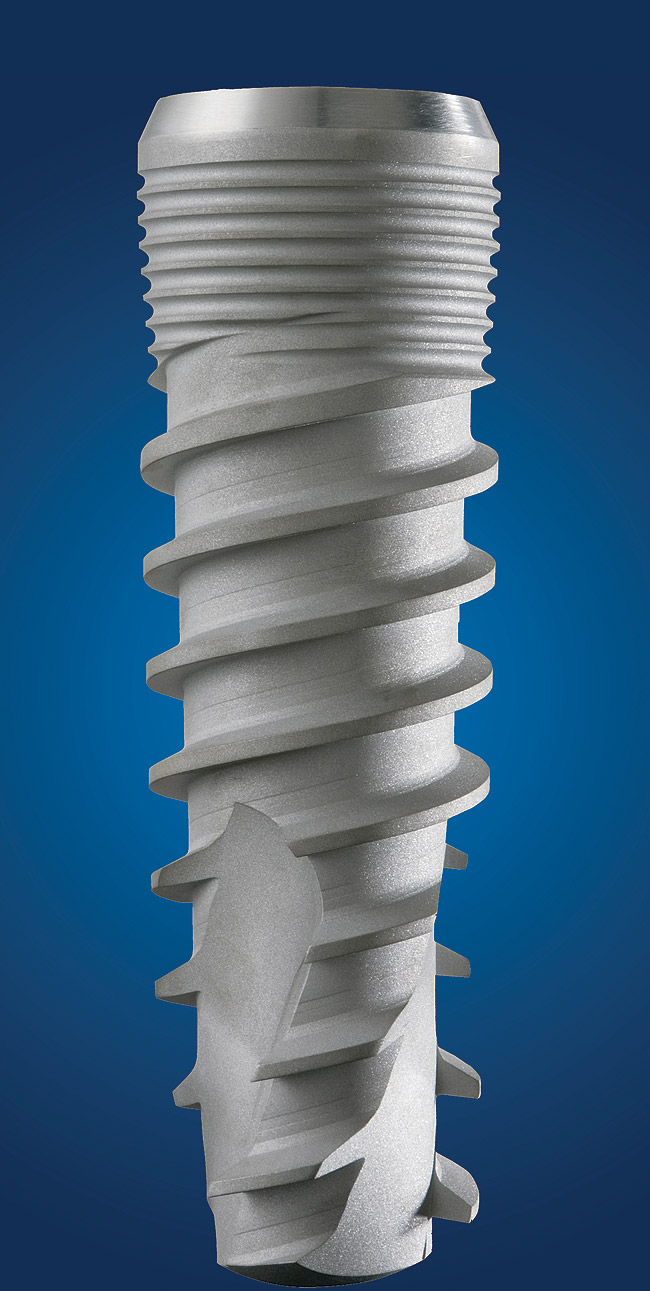 MIS Implants: Moving Implantology Forward | Compendium