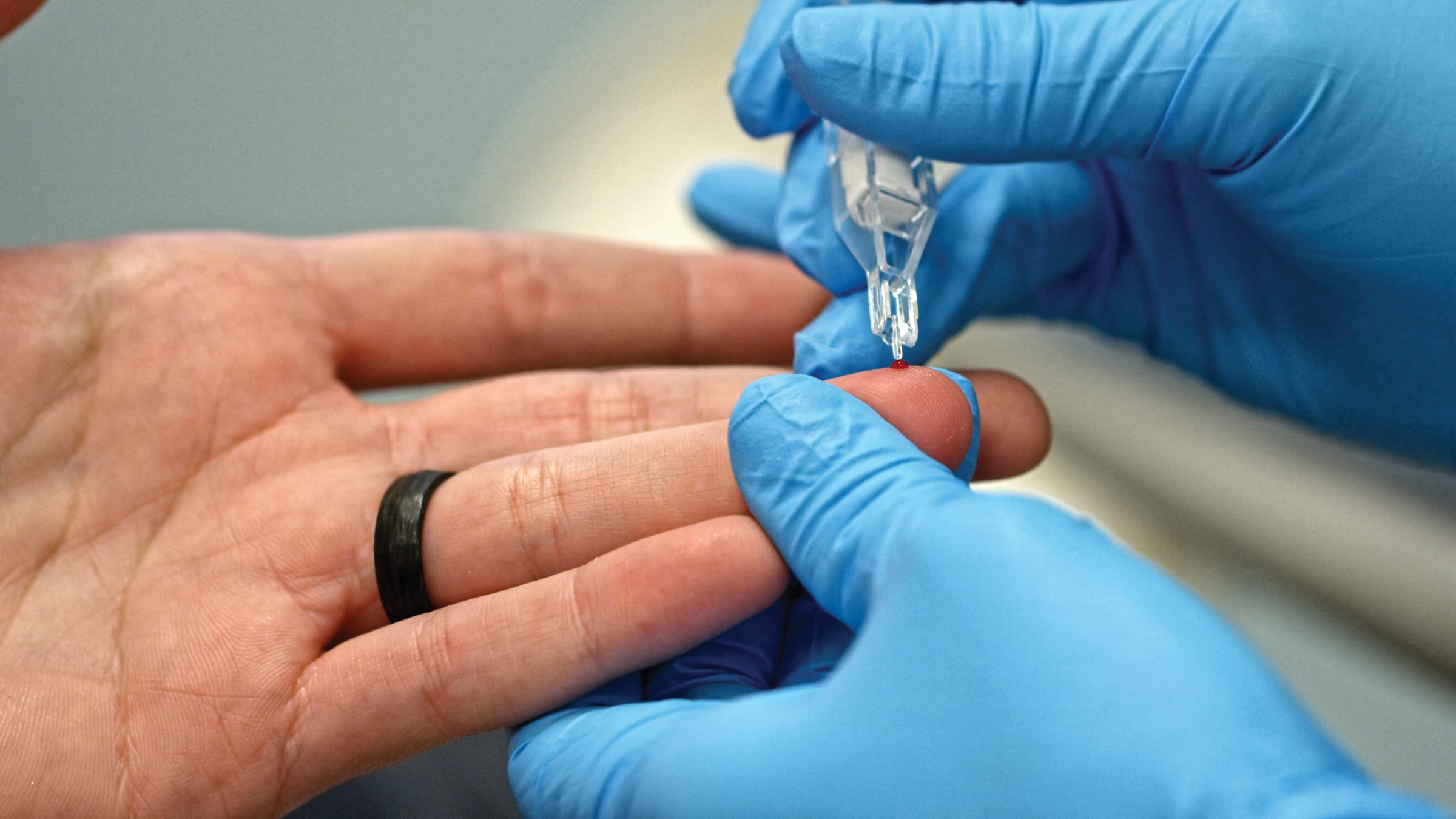 HbA1c in Dental Practices: Enhancing Patient Health Through Blood ...