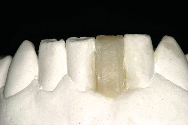 An Indirect Matrix Technique for Fabrication of Fiber-Reinforced Direct ...