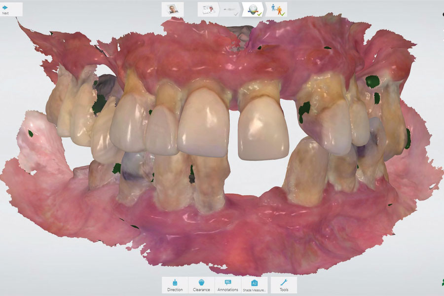 Combining Digital Technology and Traditional Principles to Optimize ...