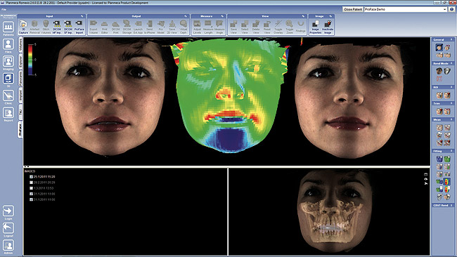 Digital Radiography: Analyzing the Benefits | Compendium
