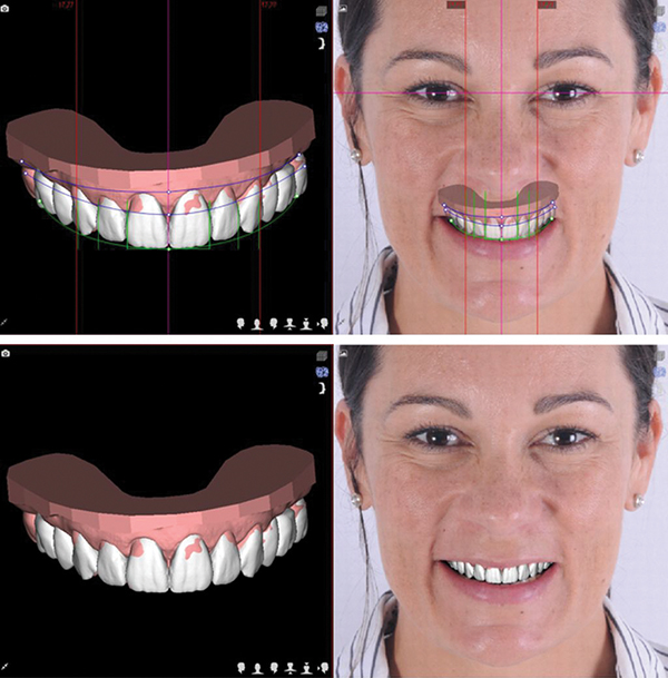Facially Driven Interdisciplinary Integrated Digital Orthodontics | Compendium