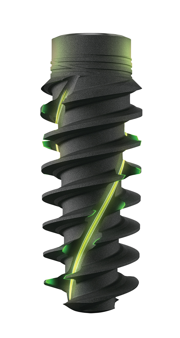 Straumann® BLX Implant Delivers on Predictable Immediate Placement ...