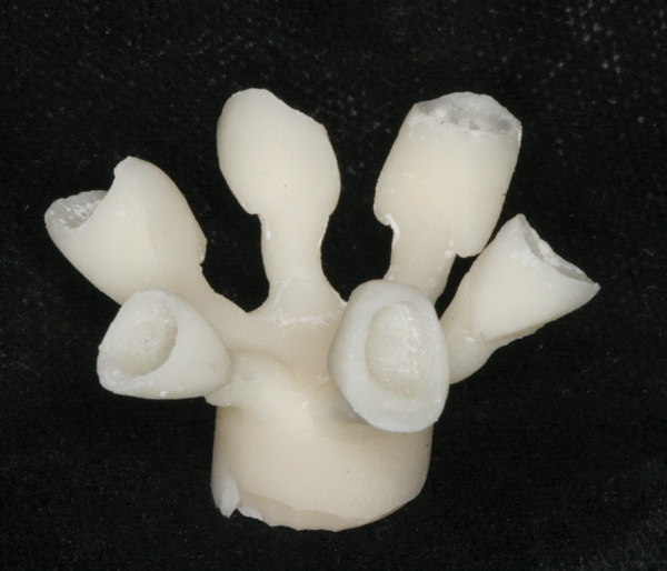 Classifying Dental Ceramics: Numerous Materials and Formulations ...