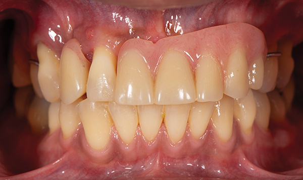 The Reverse Scan Body Protocol: Completing the Digital Workflow ...