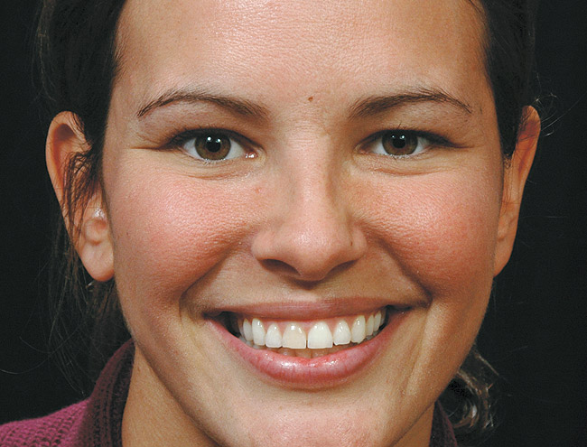 There Is More to Front Teeth Than Looks Alone - Diagnosis and Treatment ...