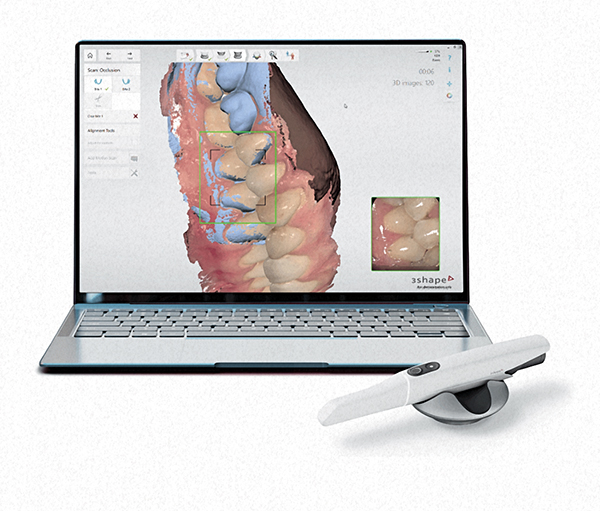 3Shape TRIOS and Unite Simplify Treatments for Busy Practitioners ...