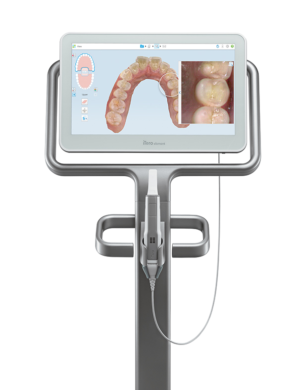 iTero® Element Intraoral Scanners Help Dentists Not Only Treat But ...