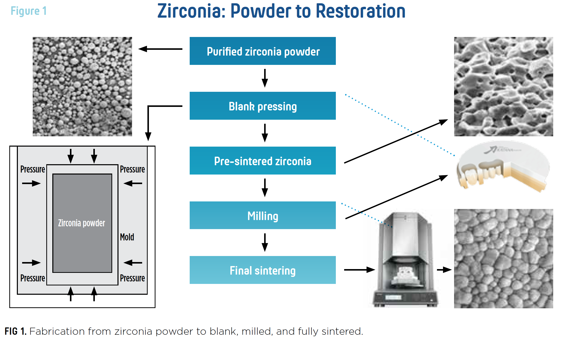 Zirconia: The Material, Its Evolution, and Composition | Compendium